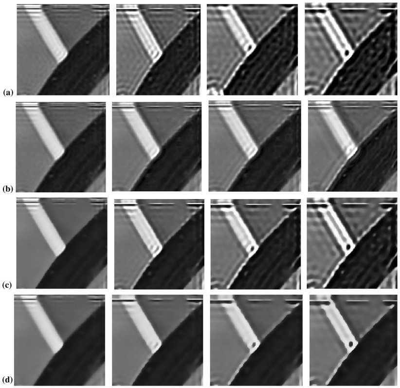 Multiscale anisotropic diffusion for ringing artifact suppression in ...